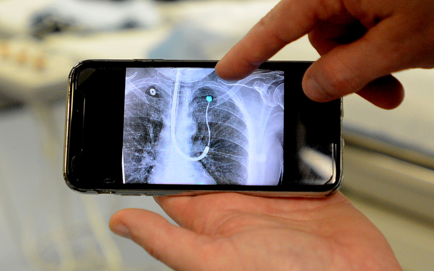 A Q&A With Pulmonologist Dr. Michael Pritchett : The Sway